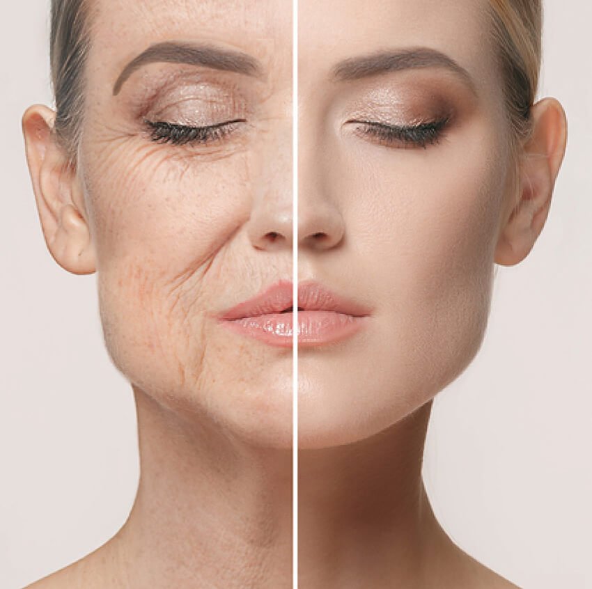 Anti-Aging Treatment – Cosmoslim Aesthetic Clinic